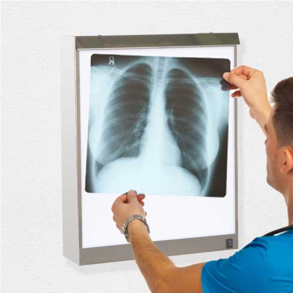 Negatoscopio | Rehabilitación Física y Neurológica